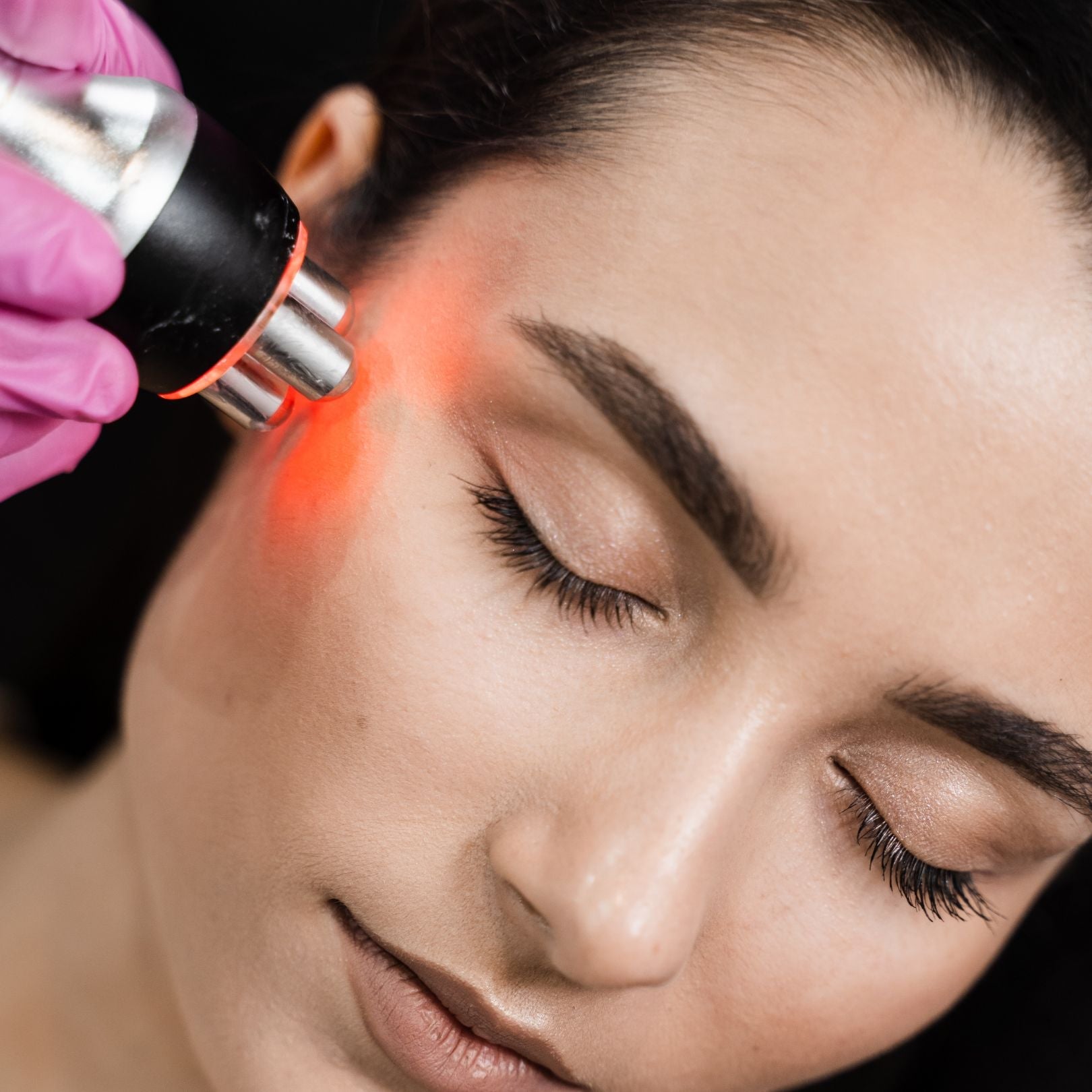 Comparing Radio Frequency Skin Tightening to Other Skin Tightening Met ...