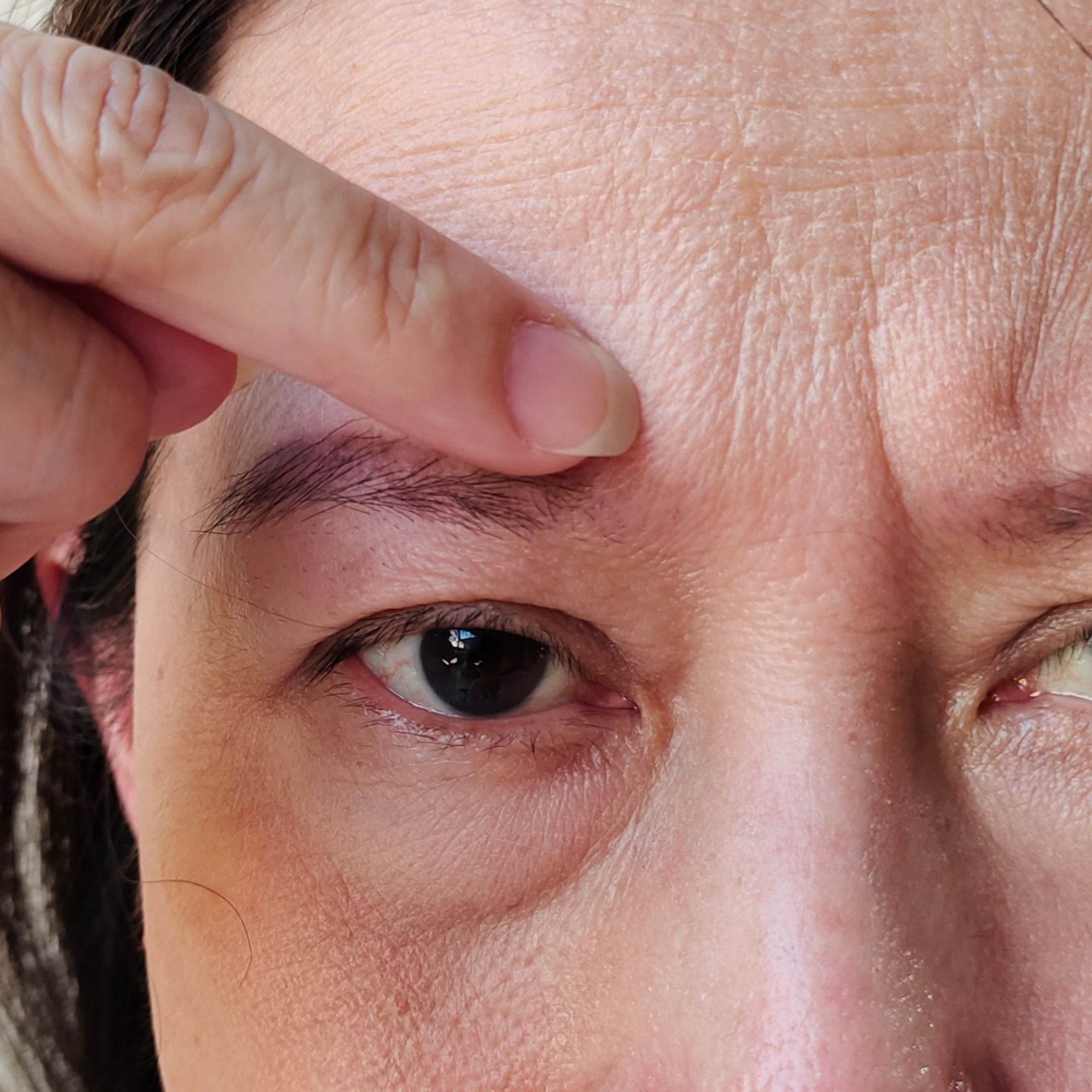 The Benefits of Noninvasive Treatments for Reducing Wrinkles and Fine ...